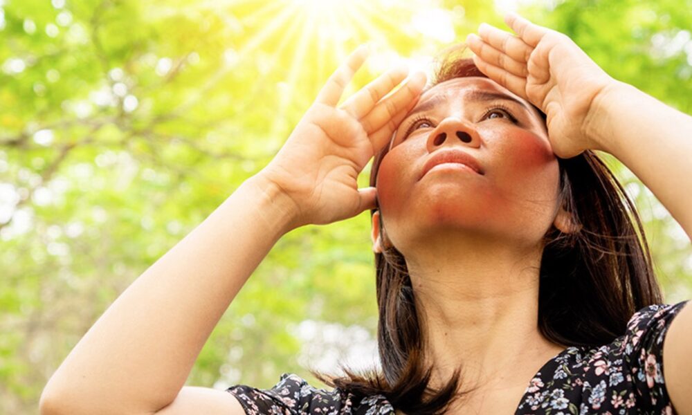 How to Treat Sunburned Eyes? - Fajar Magazine